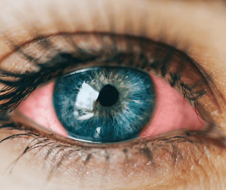 Red Evil Eye Meaning: Symbolism and Beliefs Surrounding Red Eye